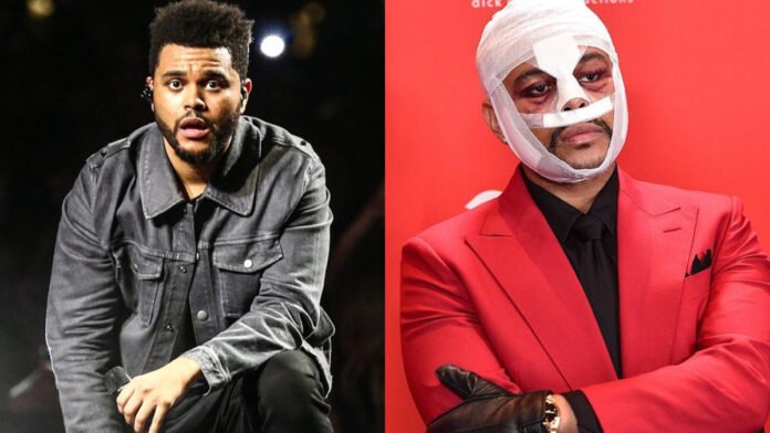 Here's Why The Weeknd Wore Face Bandages Last Year