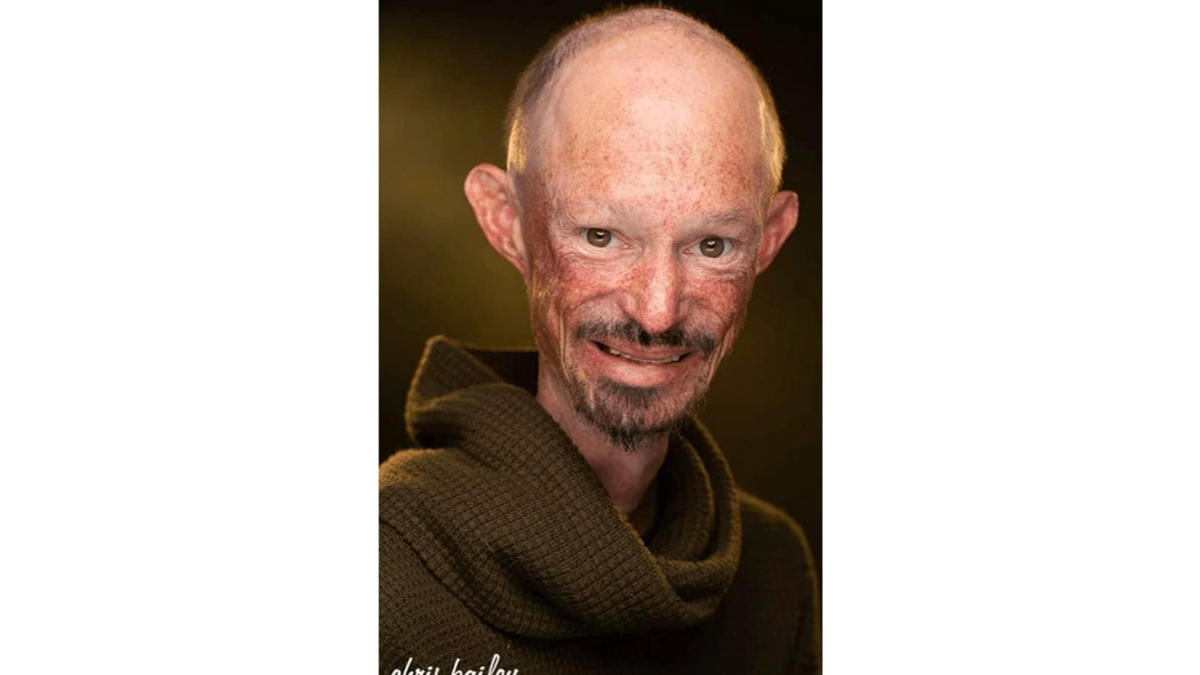 'GoT' Actor Darren Kent Dies At 39 After Prolonged Illness